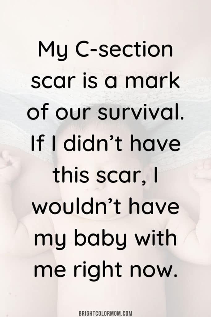 23 Inspirational C-Section Quotes About Strength and Healing